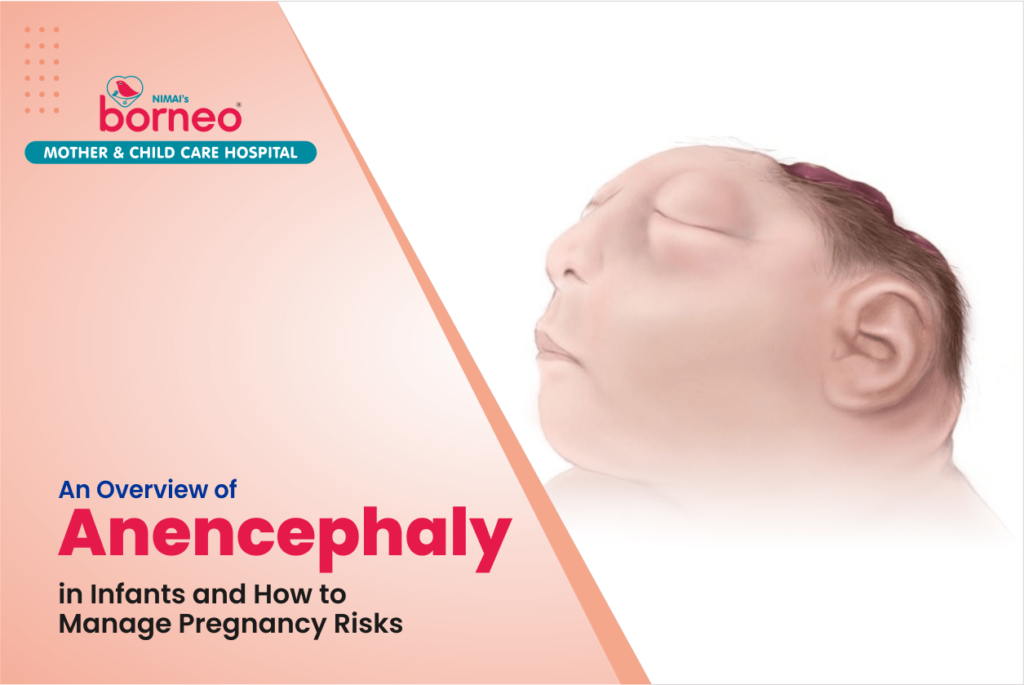 An Overview of Anencephaly - Borneo Hospitals